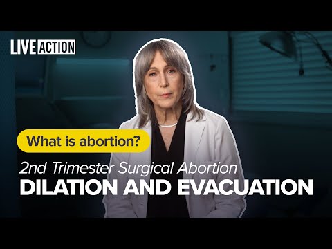 2nd Trimester Abortion | Dilation and Evacuation (D&E) | What Is Abortion?