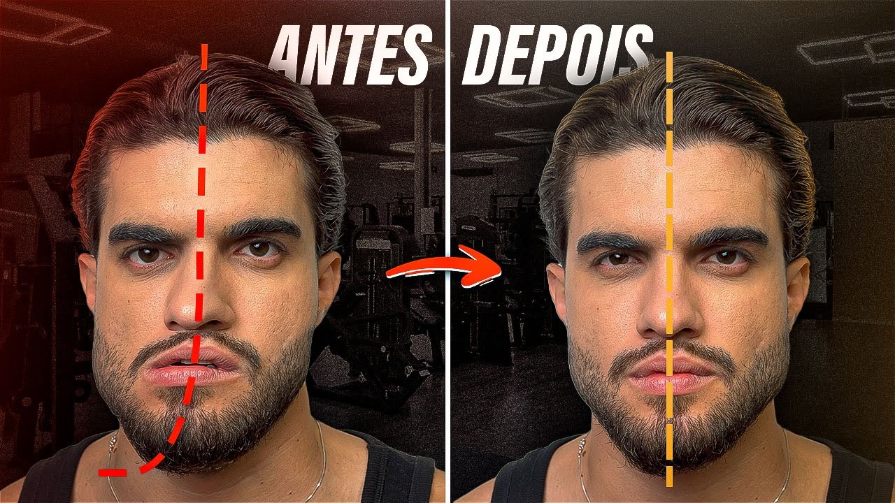 How to fix FACIAL ASYMMETRY. Practical exercises.