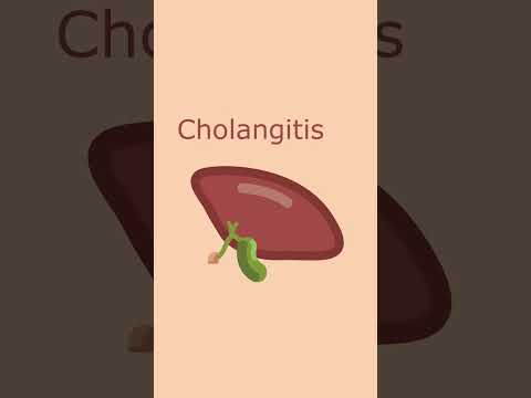 Cholangitis vs Cholecystitis - Short Comparison  #science #biology #anatomy #medicine