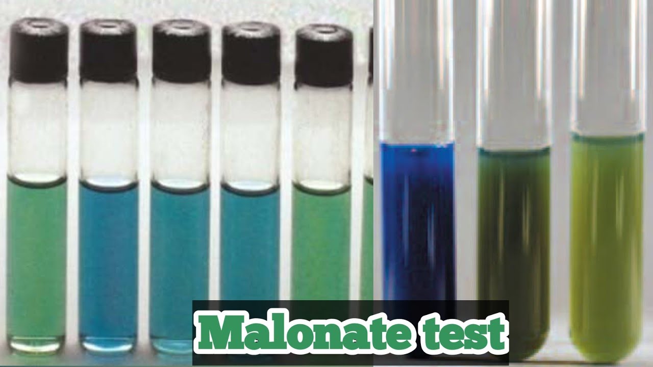 Malonate test: biochemical test lecture 35