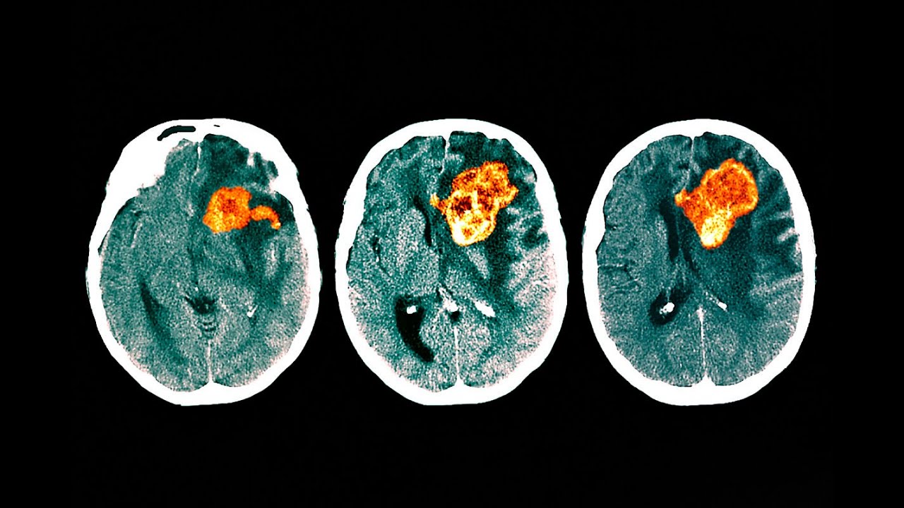 1.1 EXPLORATION | Biomedical Image Analysis in Python - DataCamp Course