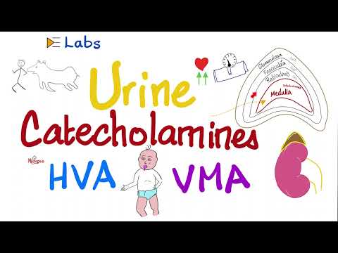 Catecholamines (Epinephrine, No-Epinephrine, Dopamine), Metanephrines, HVA, VMA | Pheochromocytoma