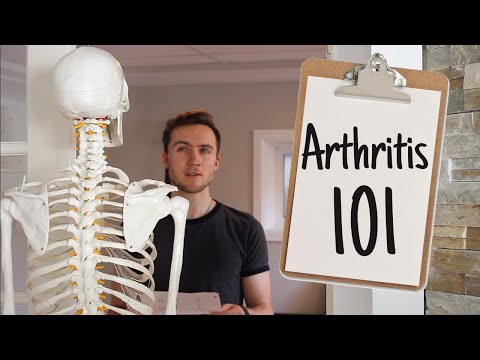 What Exactly is Arthritis? | Physiotherapist Explains Osteoarthritis