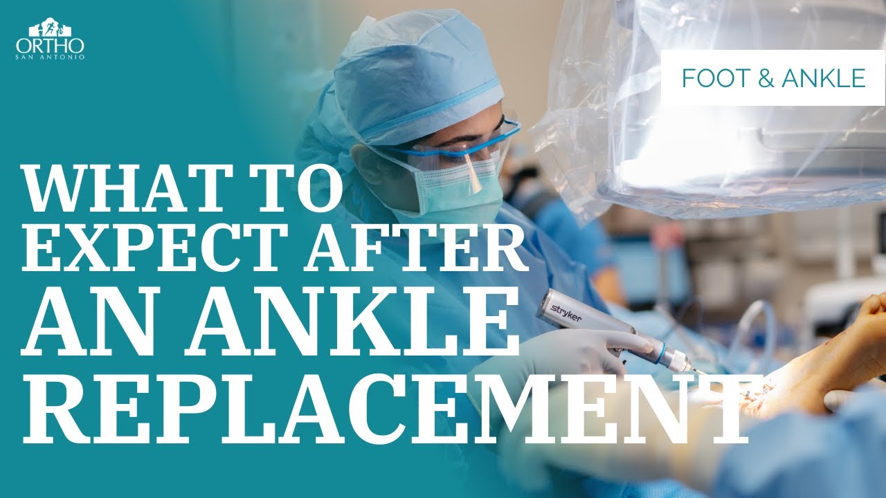 Ankle Replacement Surgery #recovery