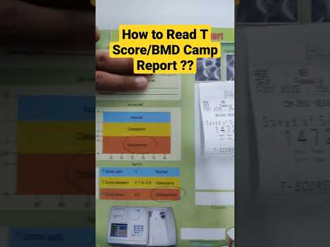 How to Read T Score/BMD Camp Report ?? Dr Sai Chandra MBBS DNB Ortho
