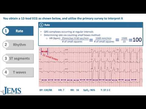 ECG Consult 39yo Firefighter Complaining of Dyspnea on Exertion