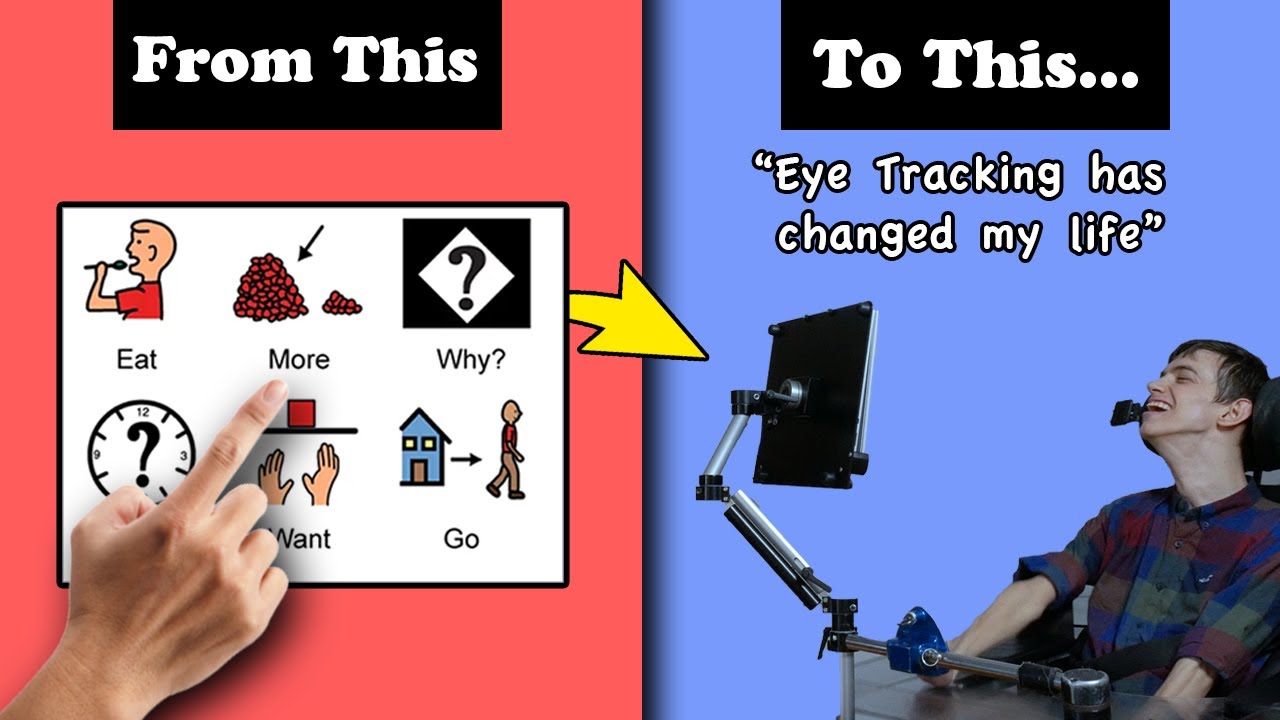 The Evolution of AAC