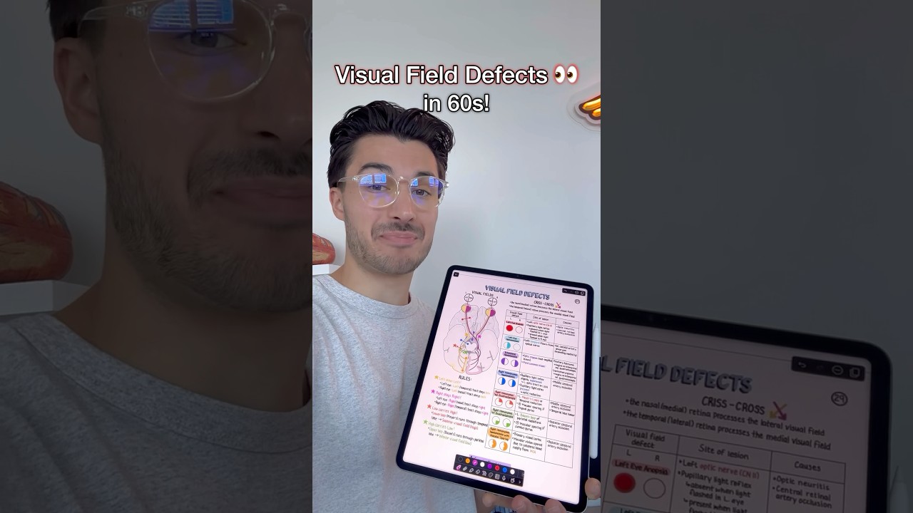 Easy trick for Visual Field Defects 👀❌ #medstudent #medschool ##usmle #usmlestep1 #neurology