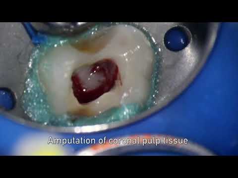 Dental Treatment Services in India