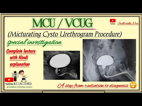 #MCU(Micturating Cysto-Urethrography) Procedure #VCUG(Voiding Cysto-Urethrography) Procedure