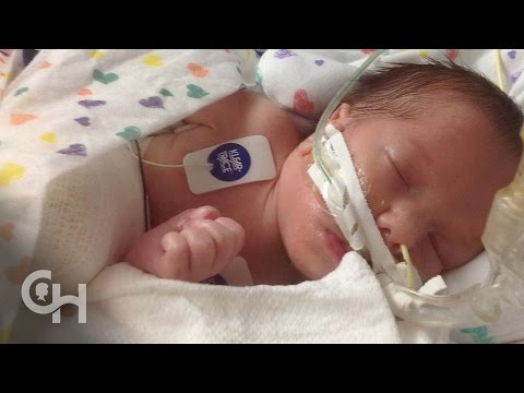 Jameson’s Omphalocele Story: Look at Him Now
