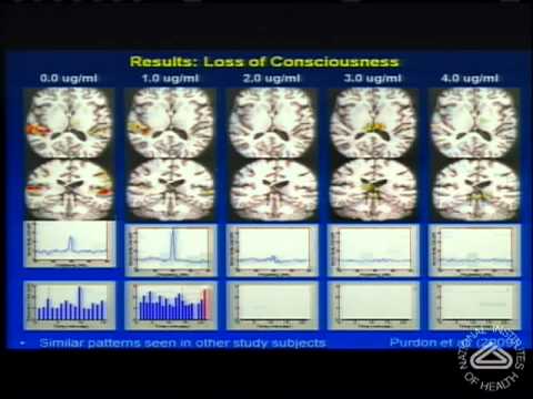 A Look at the Unconscious Brain Under General Anesthesia