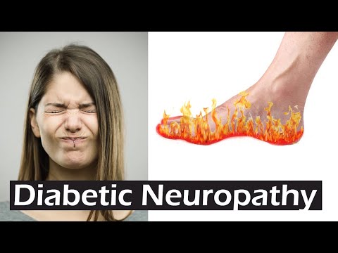 Diabetic Neuropathy - diabetic nerve pain in leg