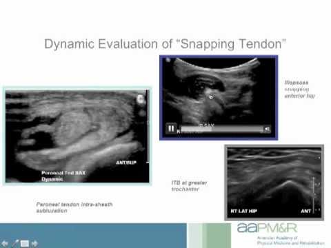 Advanced Diagnostic and Interventional Ultrasound Techniques for Tendinopathy Course Preview