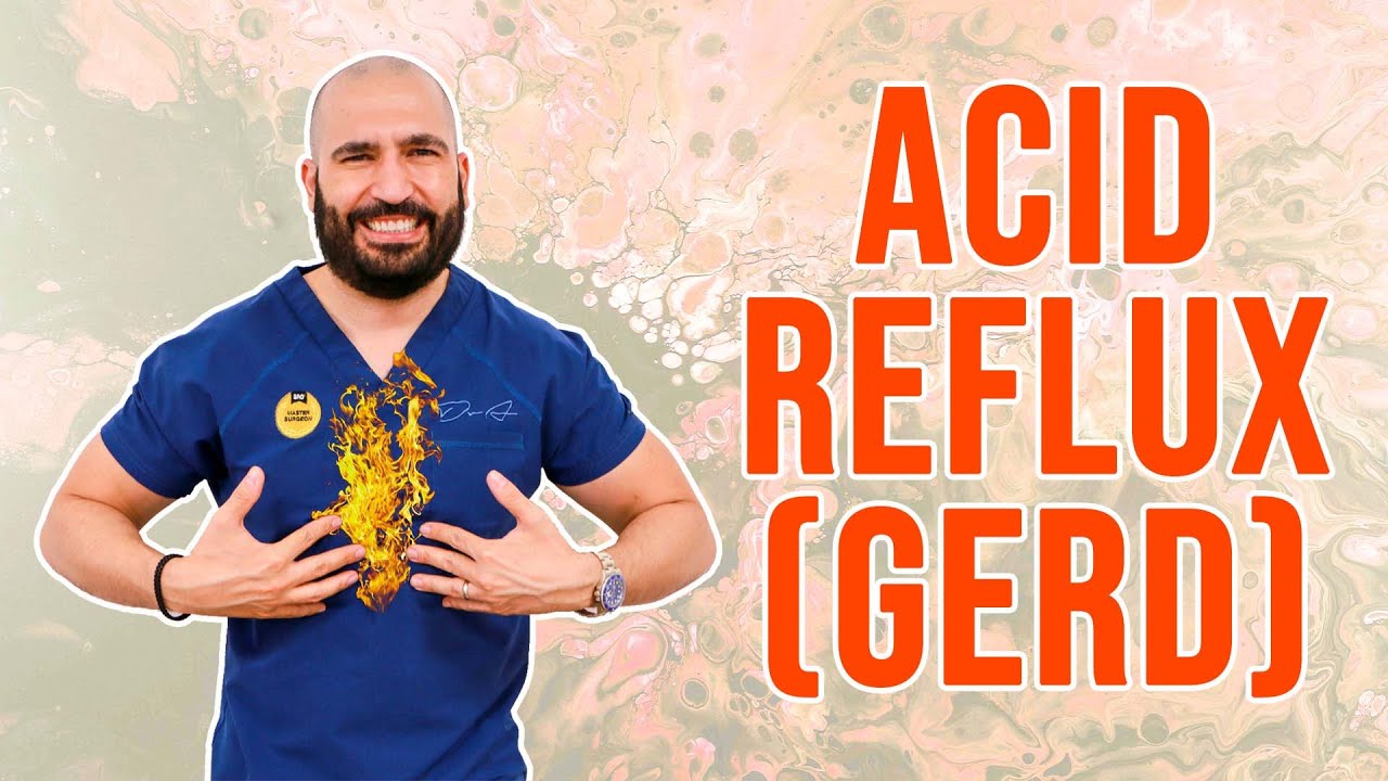 Acid Reflux (GERD) | Gastric Sleeve Surgery | Questions and Answers