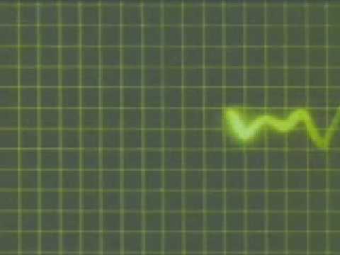 Movie Trailer - 1981 - Scanners