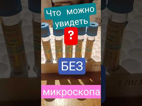 Что можно увидеть без микроскопа? #карнивор #анемия #кетодиета