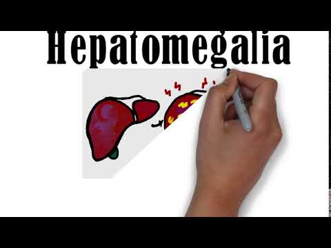 Spanish Medical Interpreter-Spanish Medical Terminology-How to Pronounce Hepatomegaly in Spanish?