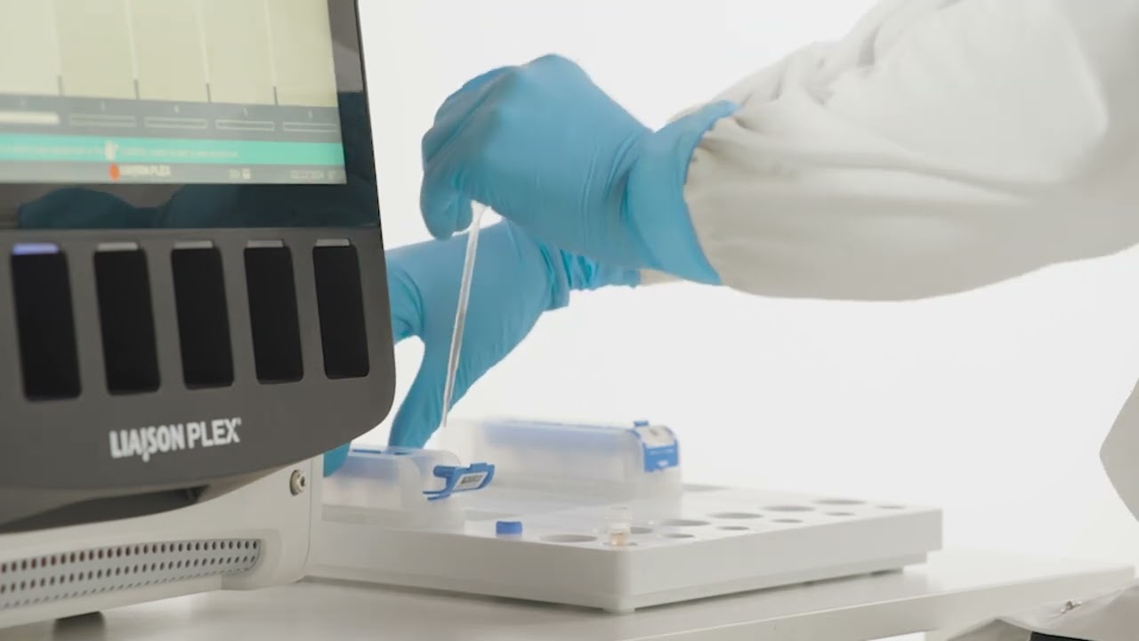 How to | LIAISON PLEX®