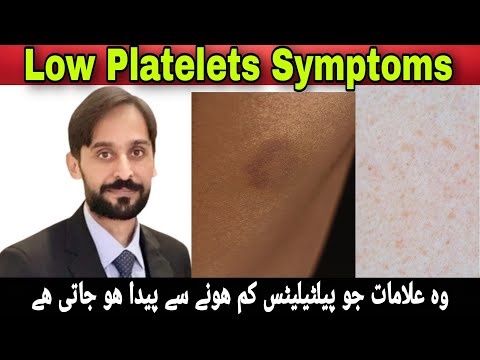 Symptoms of Low Platelet Count