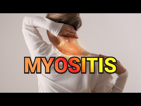 Myositis (updated 2023) - CRASH! Medical Review Series