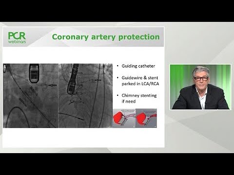 TAVI and coronary access risk management - PCR Webinar
