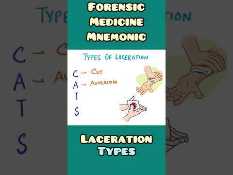 Laceration : Types - mnemonic | Forensic Medicine , Surgery | #shorts