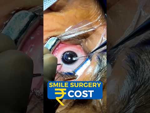 Smile Surgery Cost