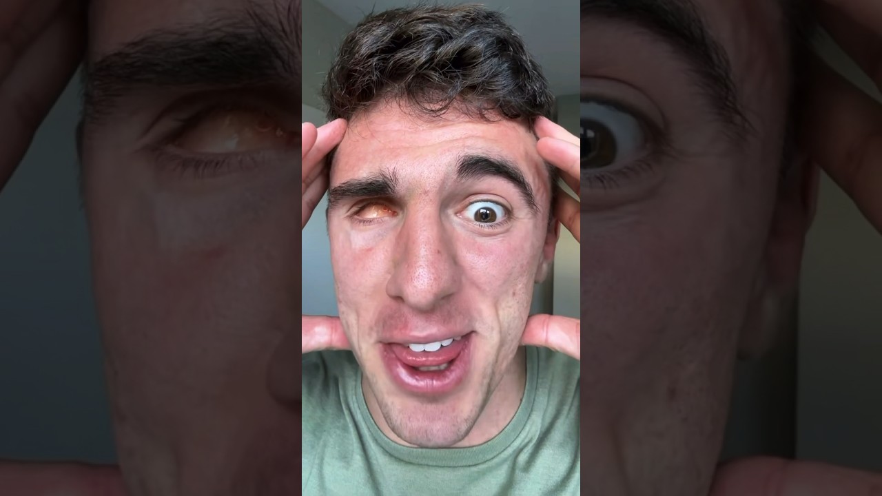 YOUTUBE EYEBALL 😳