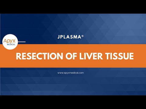JPlasma | Resection of Liver Tissue