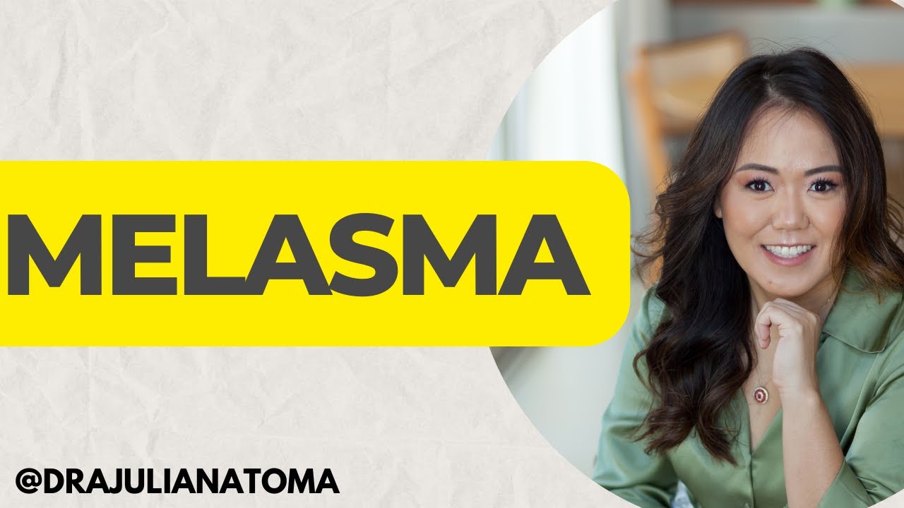 TUDO SOBRE MANCHAS E MELASMA / DERMATO DRA JULIANA TOMA