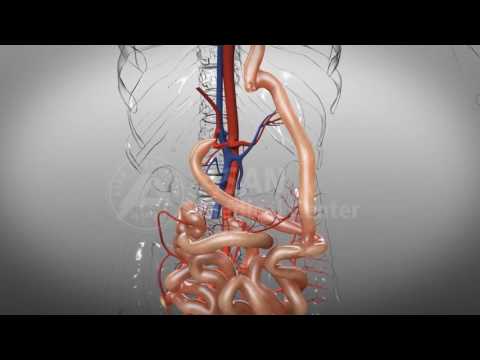 Total Gastrectomy