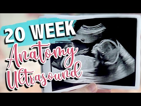 20 WEEK ANATOMY ULTRASOUND | Anatomy Scan 20 Weeks Pregnant | Gender Confirmation | The Carnahan Fam