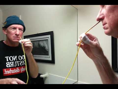 NG Tube removal