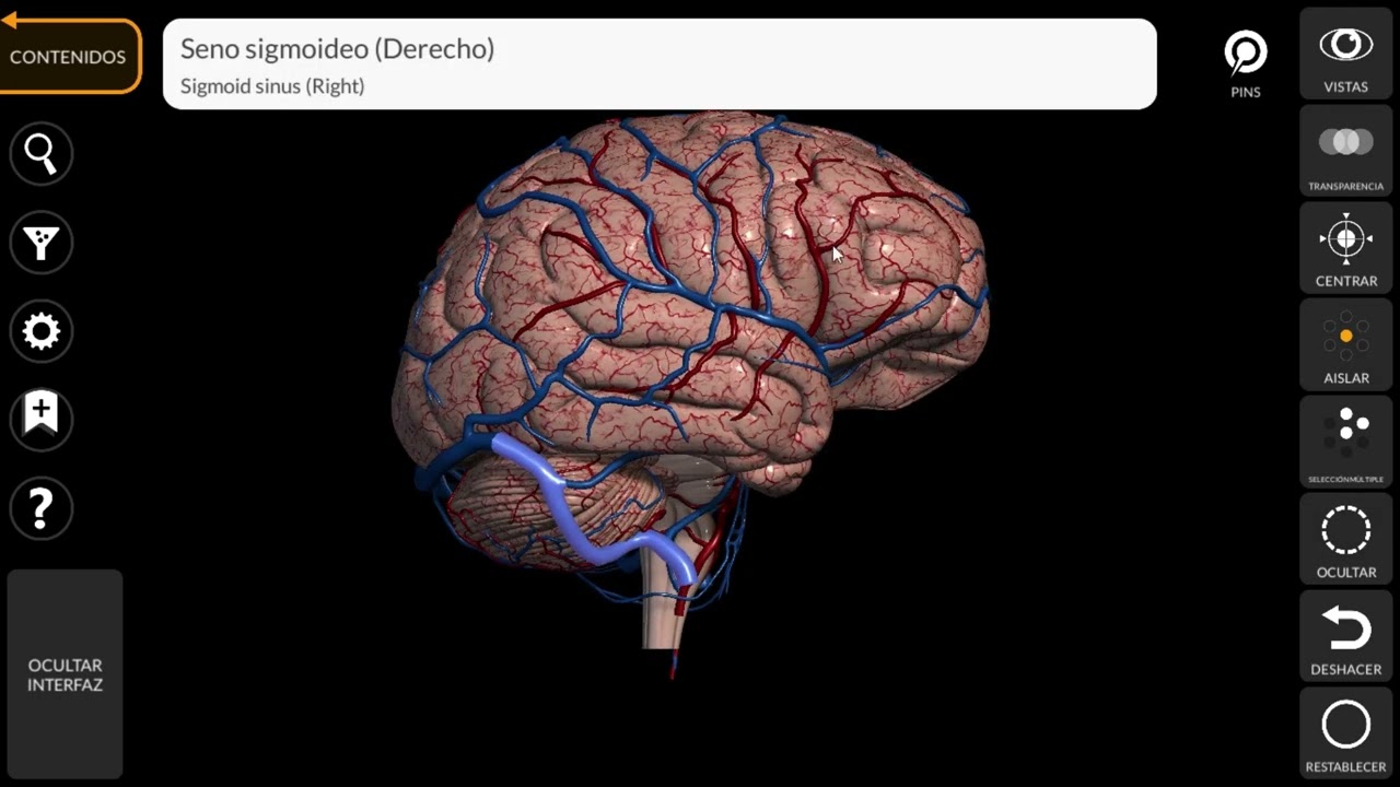 Senos venosos cerebrales