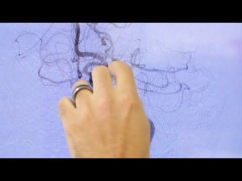 Warning signs of a stroke