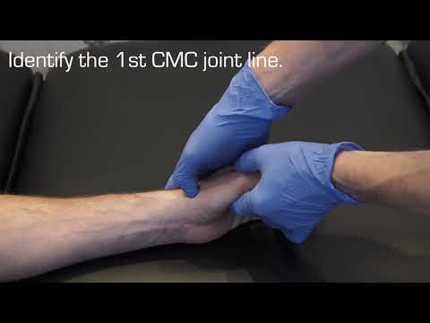 Injection Technique for Osteoarthritis of the 1st CMC Joint