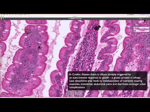 Histological transition from stomach to duodenum