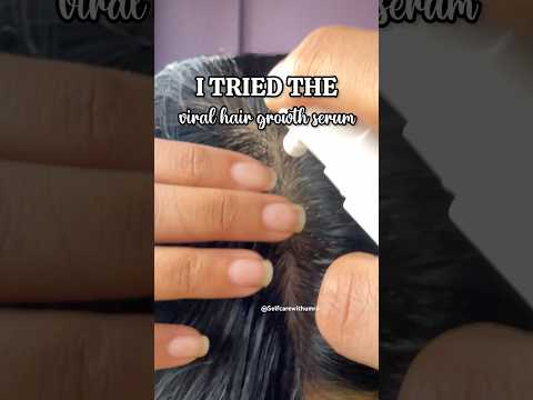 I tried the viral wishcare hair growth for 2 months hereโs my review ๐ซถ๐ป๐ #growthserum
