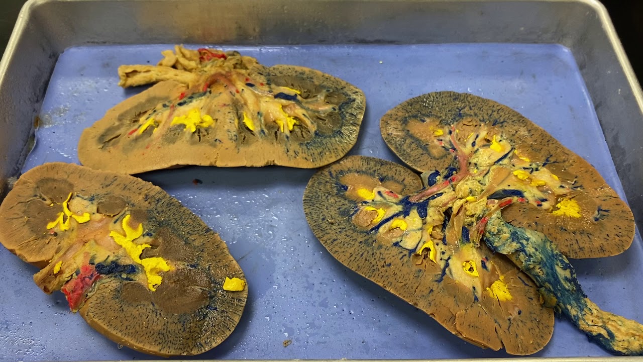 2402 Lab Urinary 6 Sheep Kidney Dissection