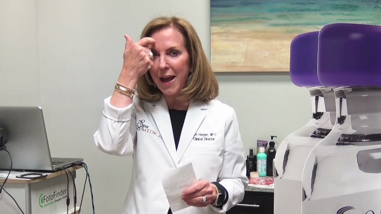 5 Things to Know Before Your First Botox Appointment