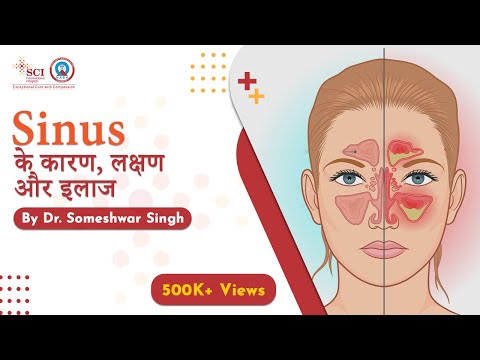Sinus के कारण, लक्षण और इलाज | Sinusitis Treatment | By Dr. Someshwar Singh
