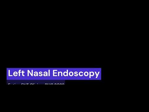 Nasal Endoscopy 31.10.2022