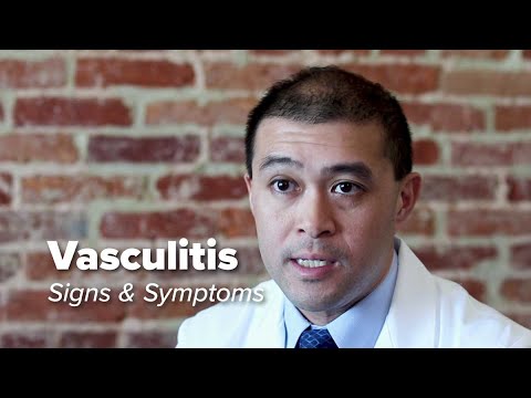 Vasculitis Signs & Symptoms | Johns Hopkins Medicine
