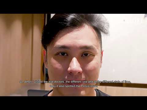 Ptosis, Droopy Eyelid Surgery in Singapore
