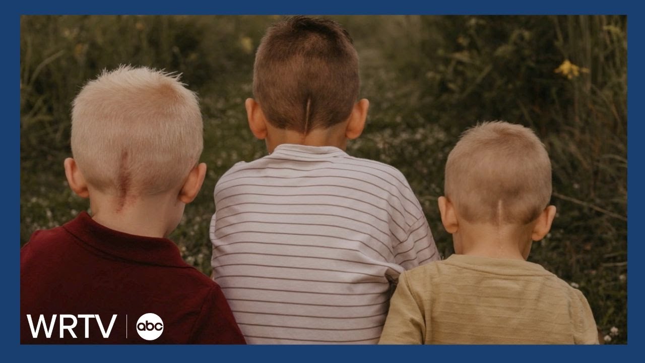 Three brothers face a rare medical condition together