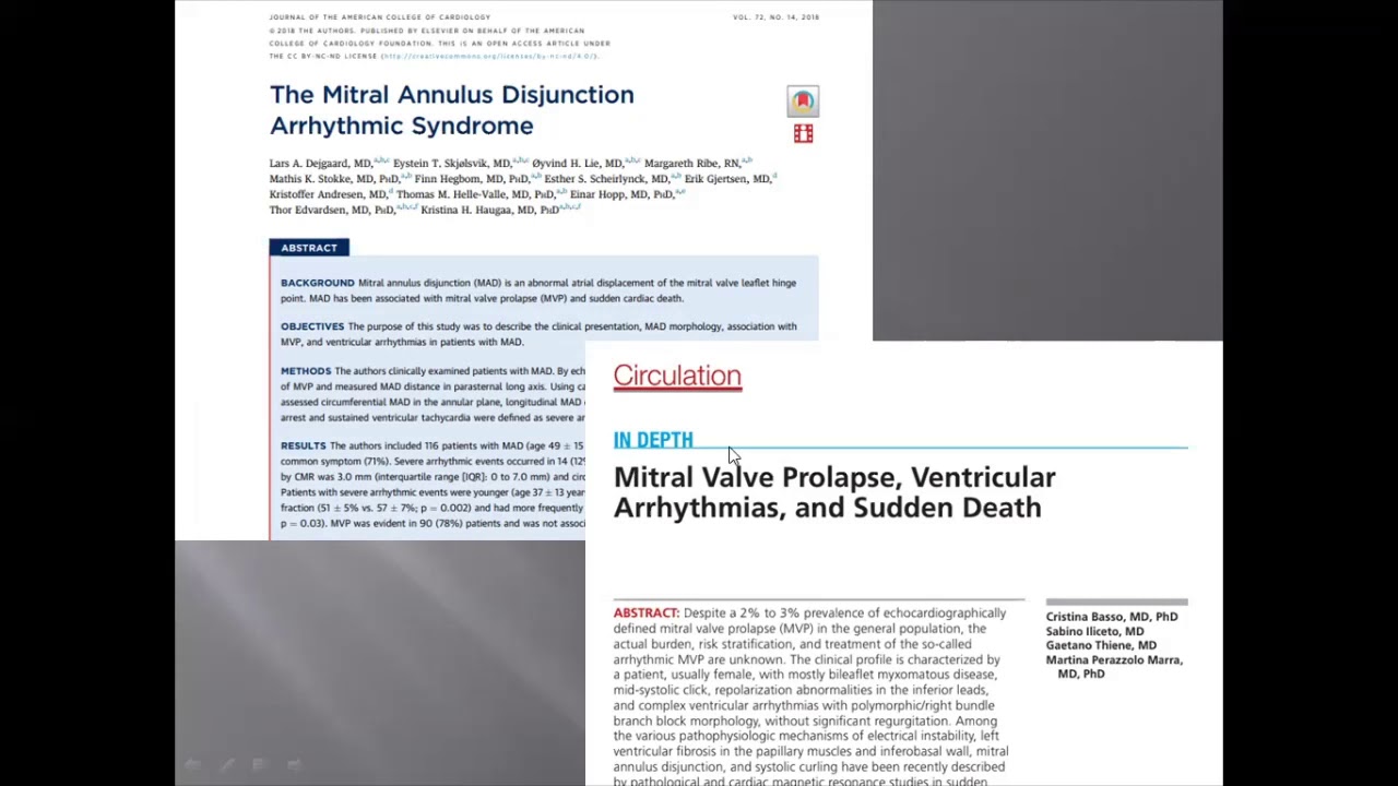 CAR - Case of the week - Case 10 - Myocardial annular dysjunction