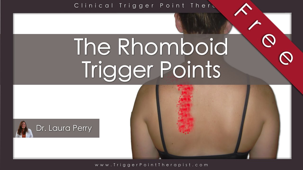 The Rhomboid Trigger Points (Free Full Video)