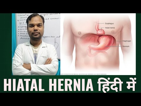 What is Hiatal hernia - Symptoms and Causes - easy explanation in hindi