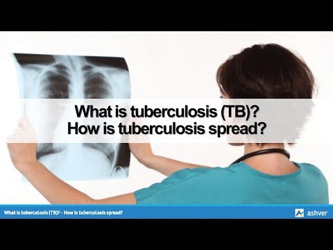 What is tuberculosis (TB) - How is tuberculosis spread